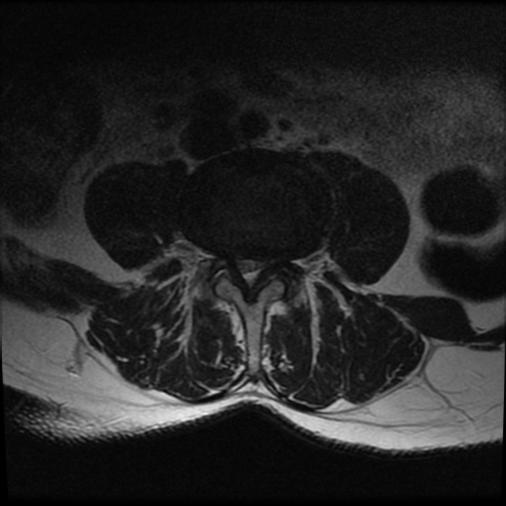 test one dog - Roboflow Universe