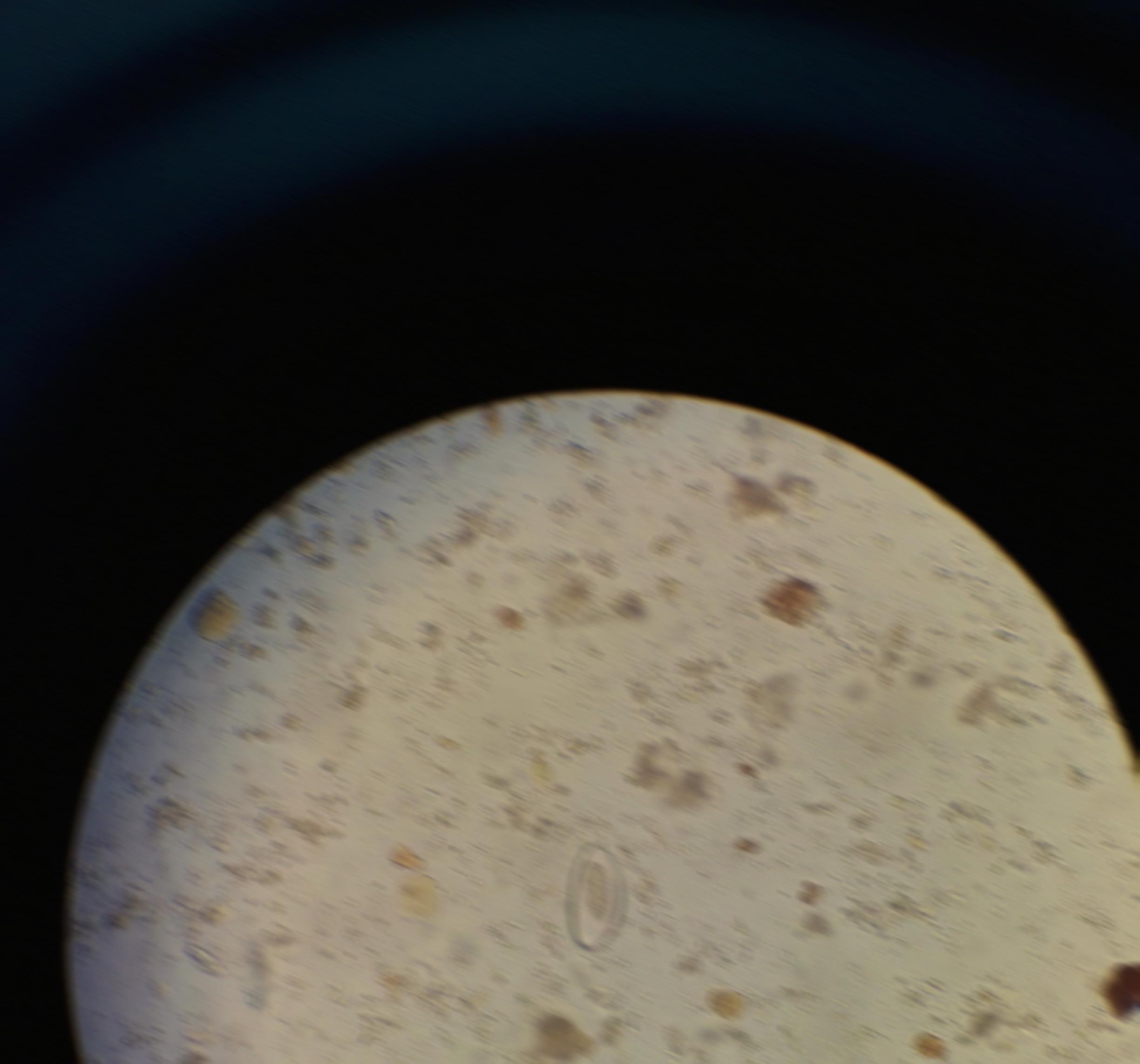 enterobius-vermicularis-eggs Object Detection Dataset by Tuvshinsaikhan ...