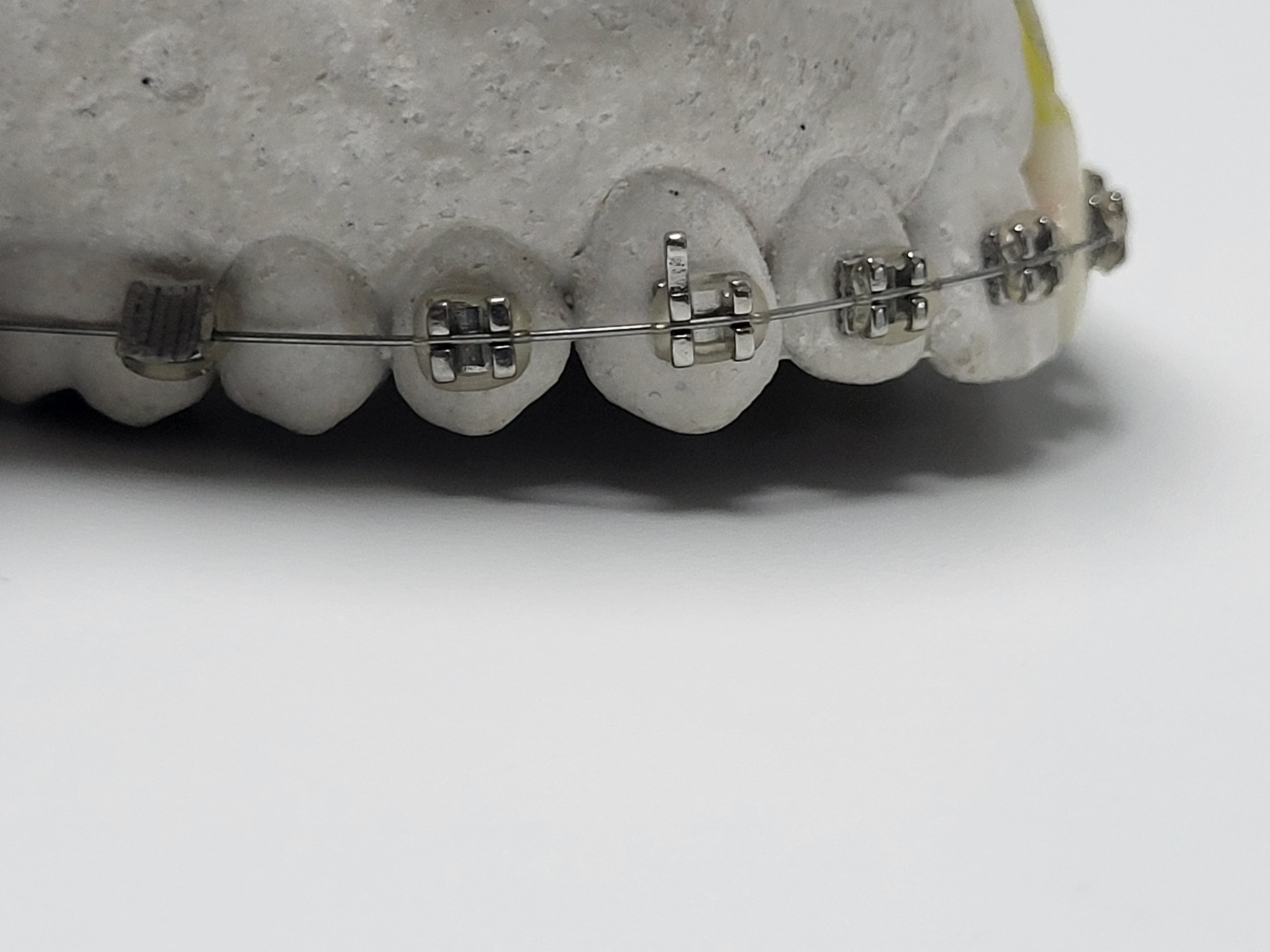 Bracket Detection Object Detection Dataset By Shenzhen Institute Of Advanced Technology