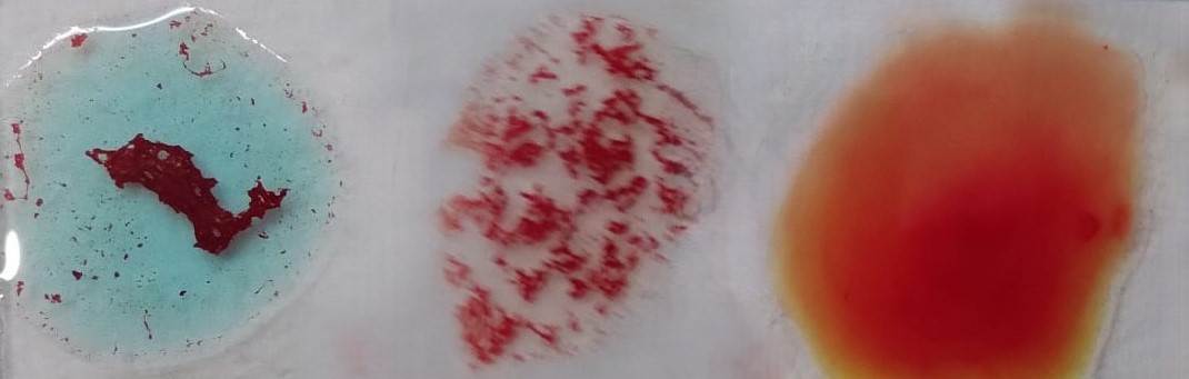 Blood Group Detection Object Detection Dataset by myprojects
