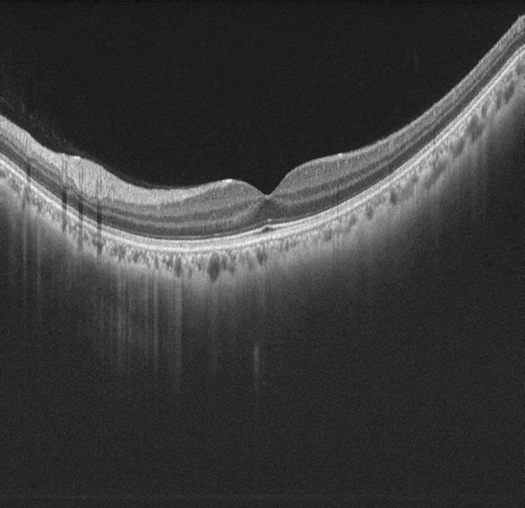 old-young-oct Semantic Segmentation Dataset by Chulkyu