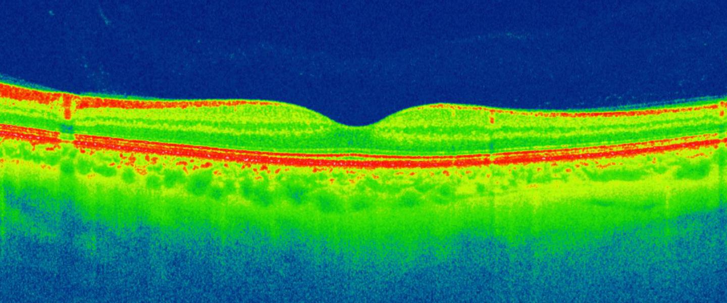 Eyes Classification Model by kk