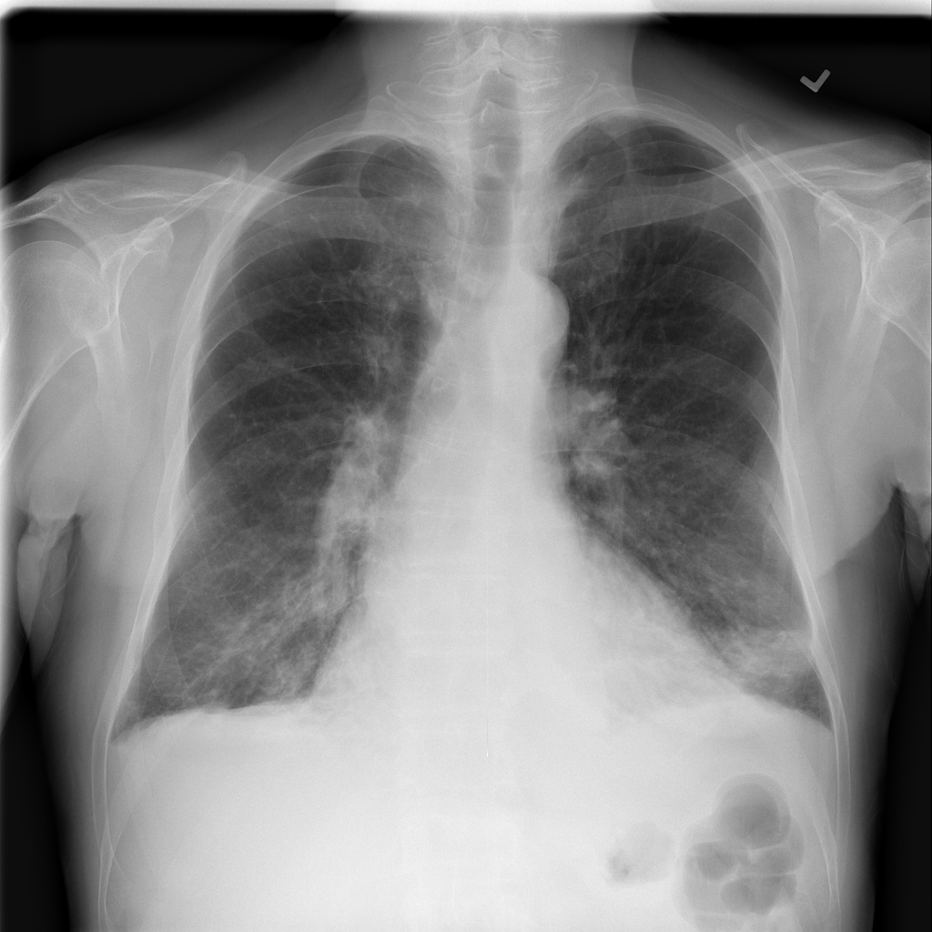 X-ray Object Detection Model by Alongkorn Lucksanaviboon