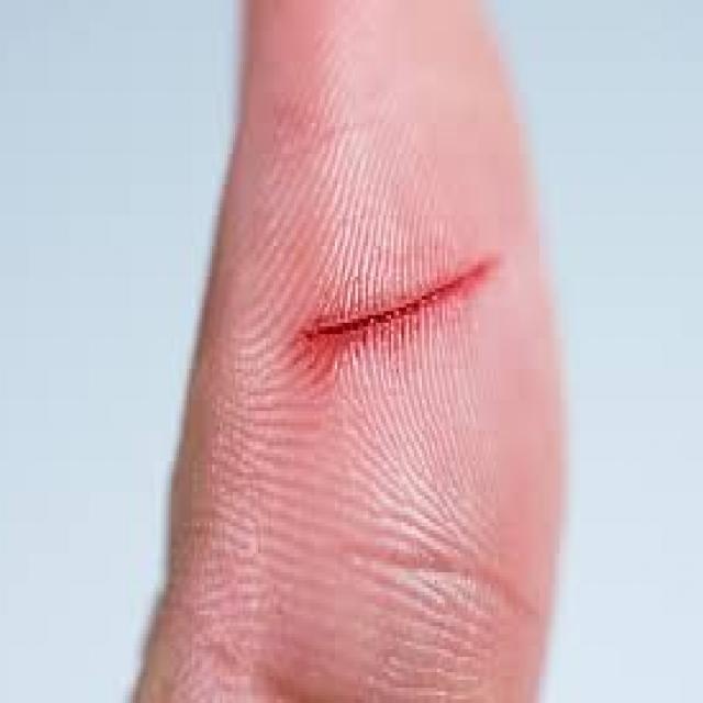 medical Object Detection Dataset (v1, 2025-03-14 12:33pm) by Drhassan