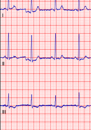 How to Use the ecg leads detection Object Detection API
