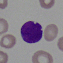 WBC - SegFormer Instance Segmentation Dataset and Pre-Trained Model by ML Proyect