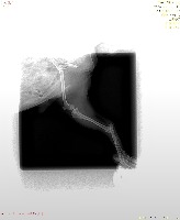 Task (task-edfm5) - Roboflow Universe