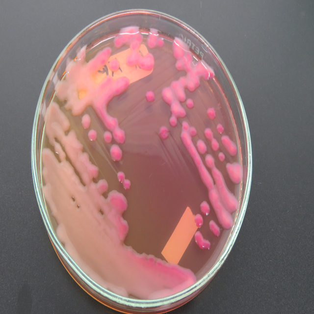 Bacteria 2 Object Detection Dataset by Folder