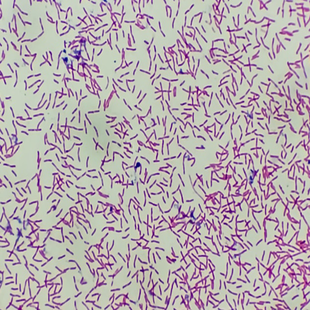 Bacteria Object Detection Dataset by Folder