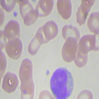 Blood cell Object Detection Dataset by airp3