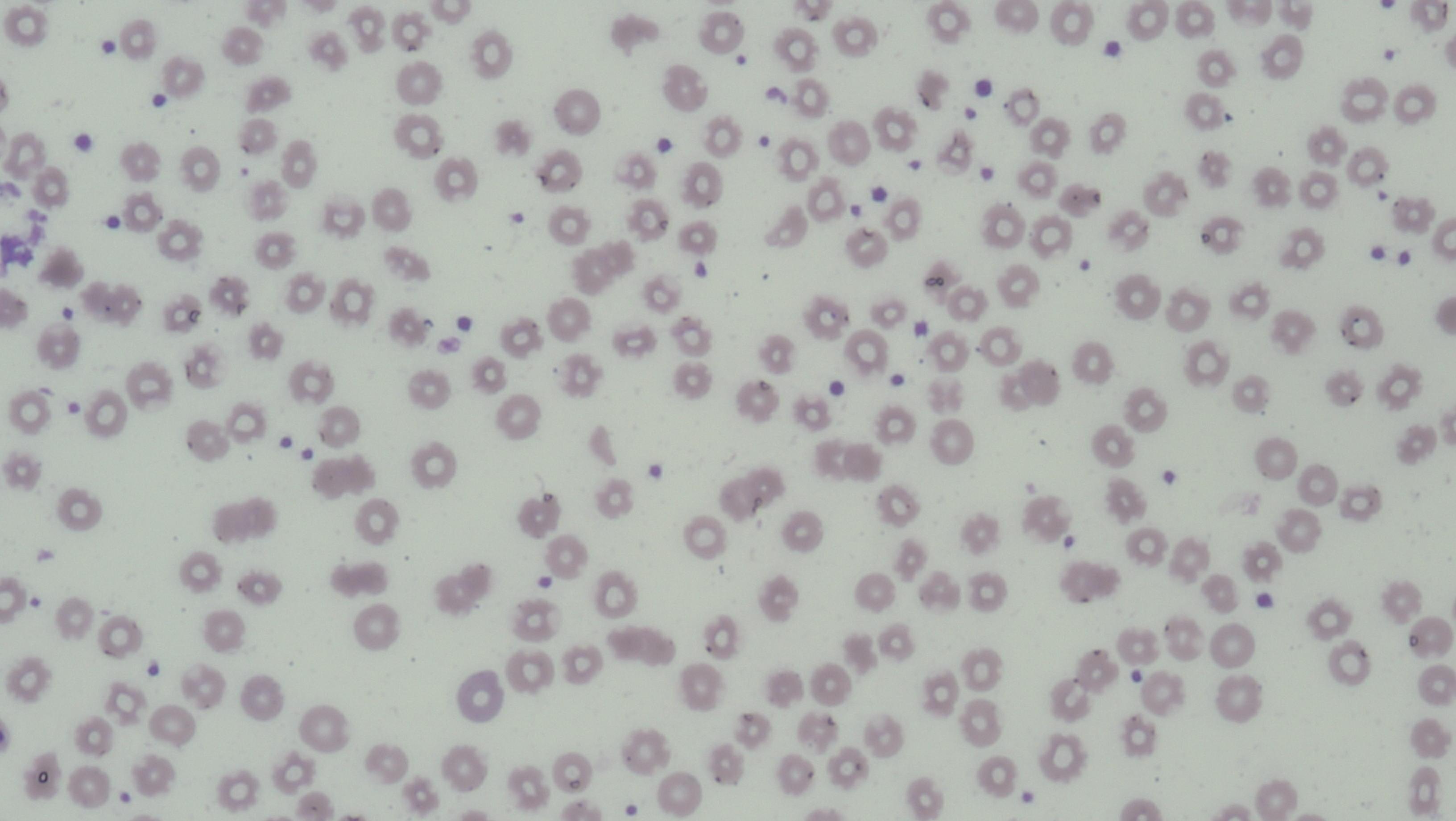 SchitoWBC Object Detection Dataset by Schistocyte WBC