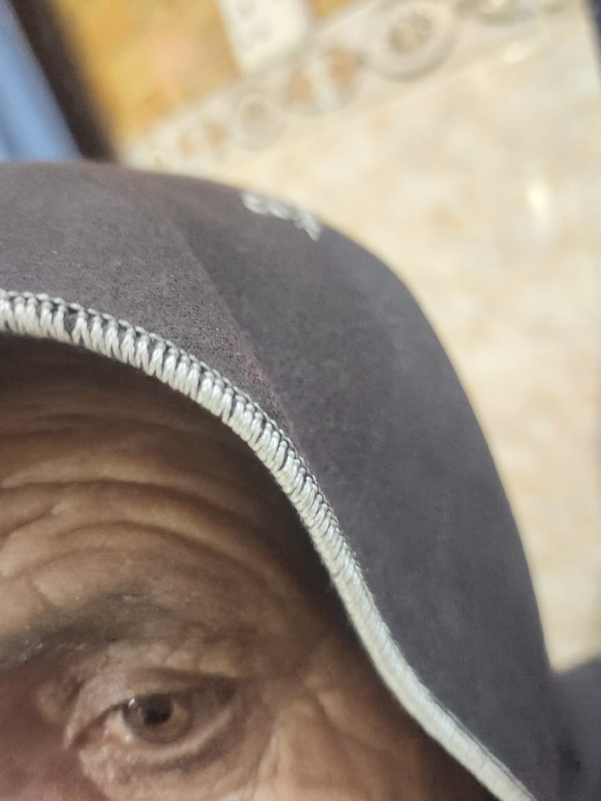 Eye Cataract Detection Instance Segmentation Model By Ai Assignment