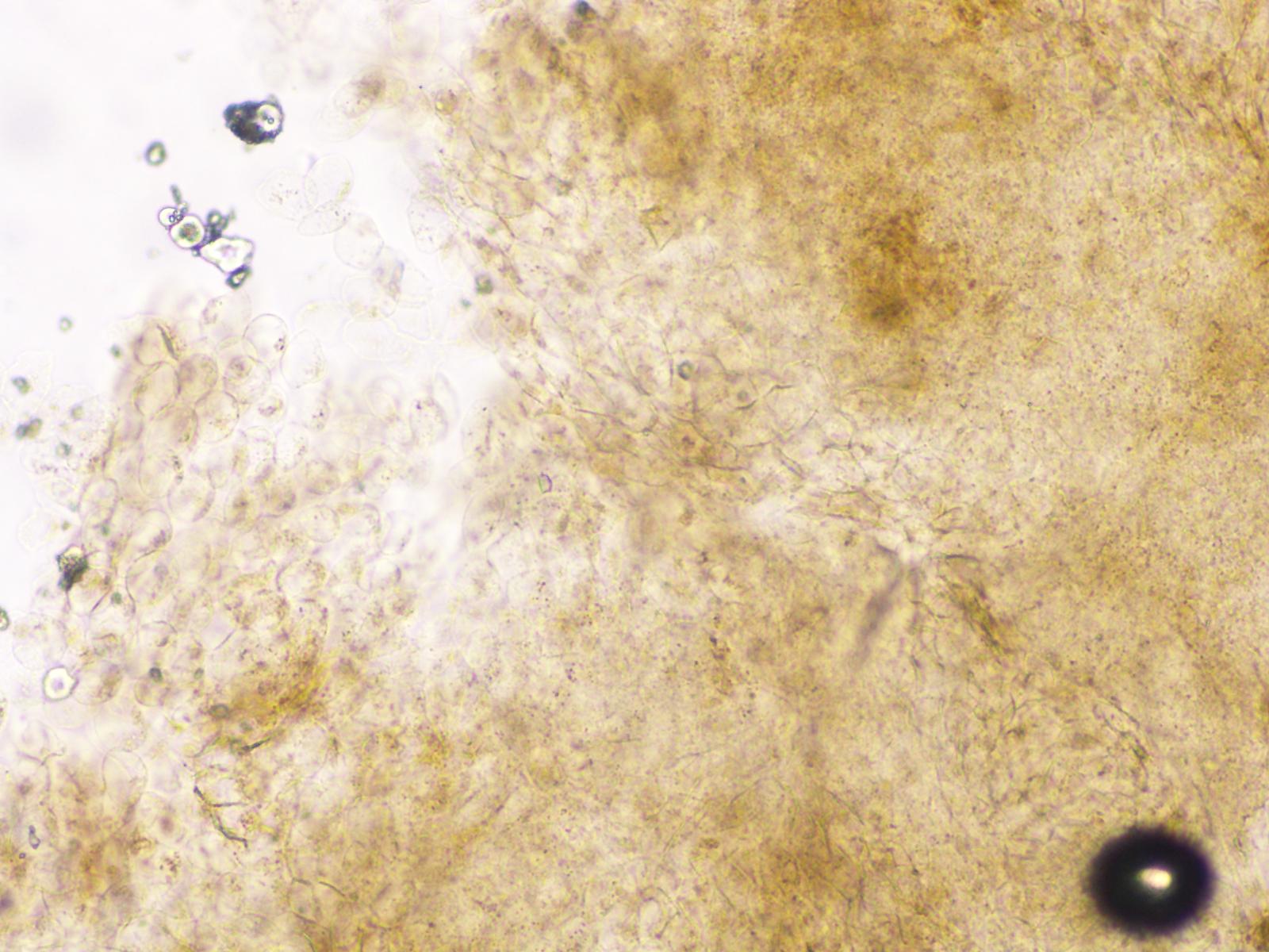 Fungus Detection Classification Dataset by Fungal Detection