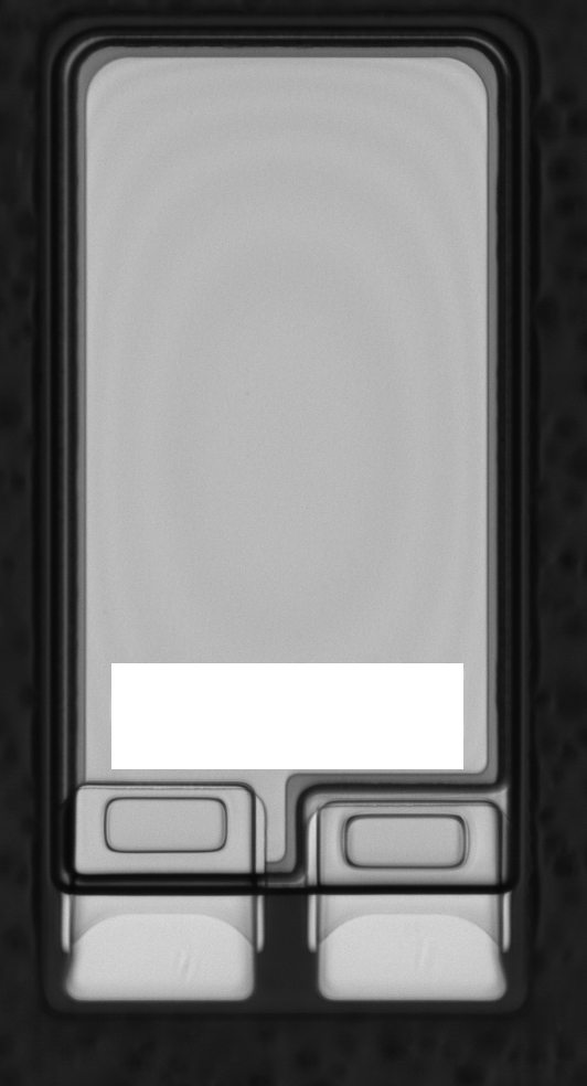 Stone Detection (stone-detection-raort) - Roboflow Universe