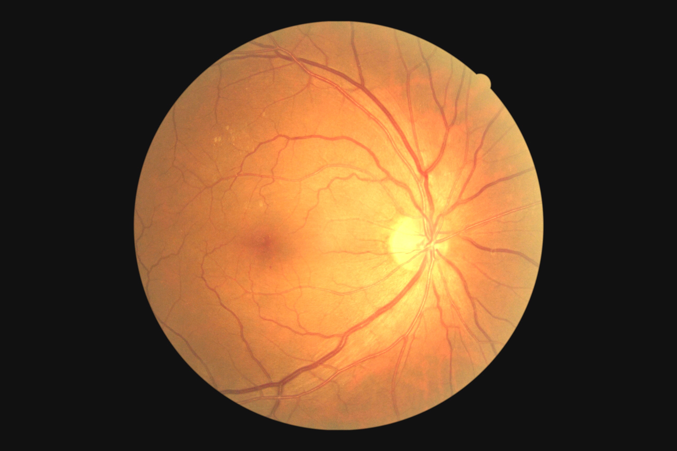 DDR-Set Object Detection Dataset and Pre-Trained Model by Jena