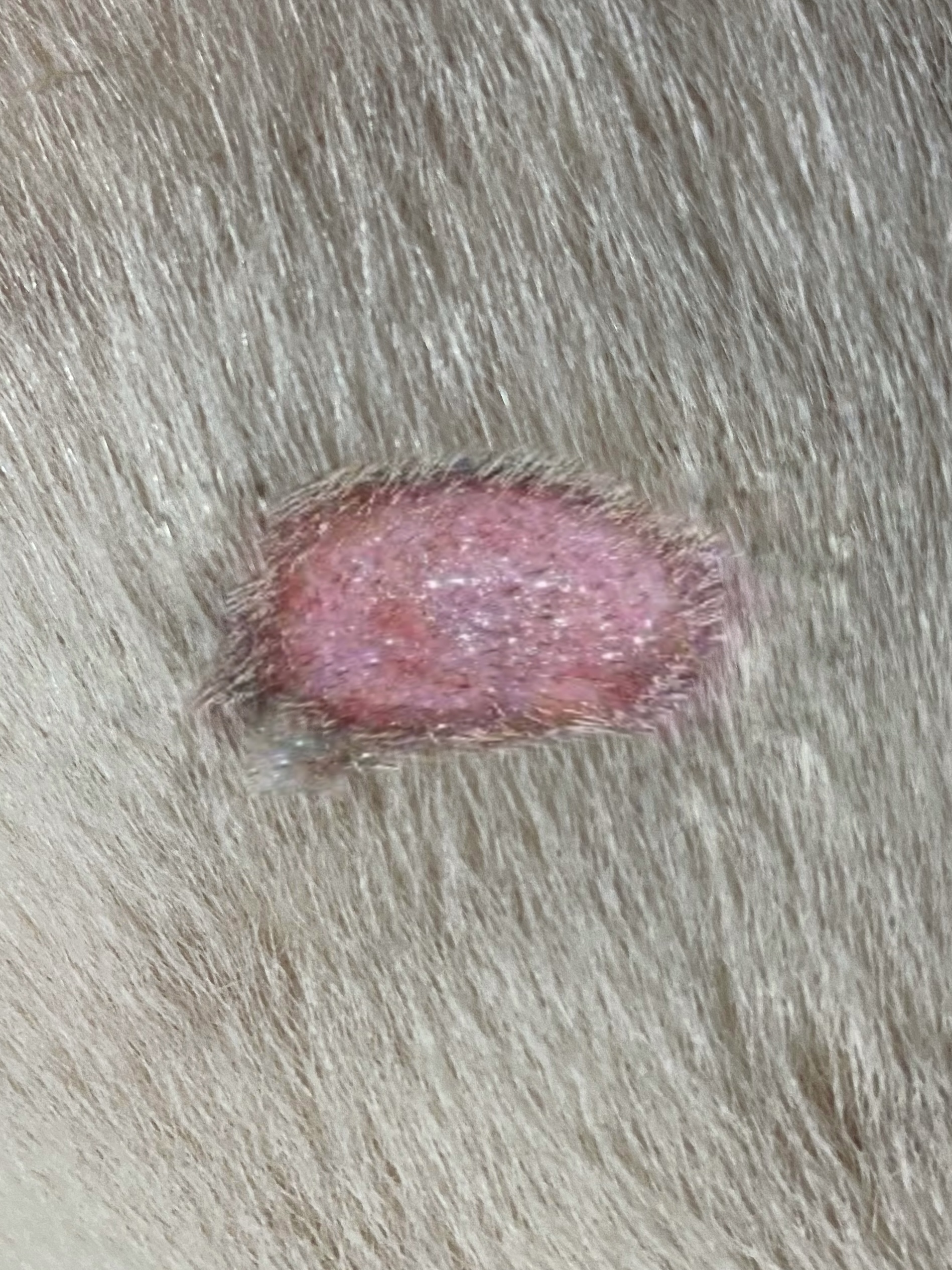 Infeccion Bacteriana Final Object Detection Dataset by hoangnha