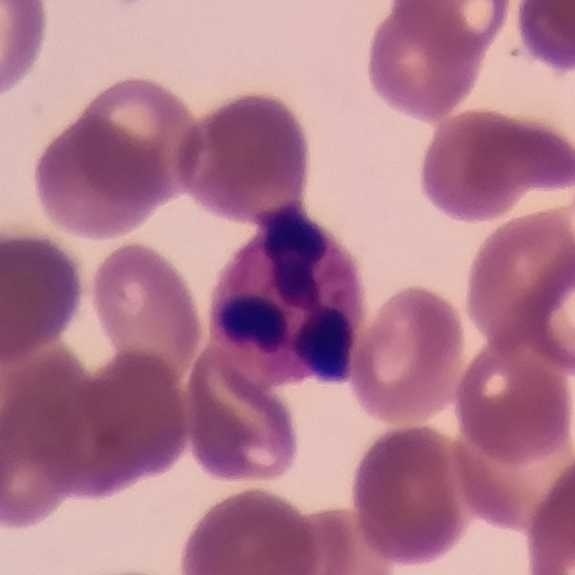 White Blood Cell Object Detection Dataset and Pre-Trained Model by school