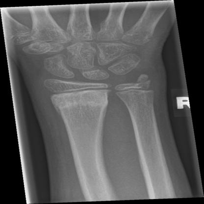 yolo_v11_grazpedwri3 Object Detection Dataset and Pre-Trained Model by ...