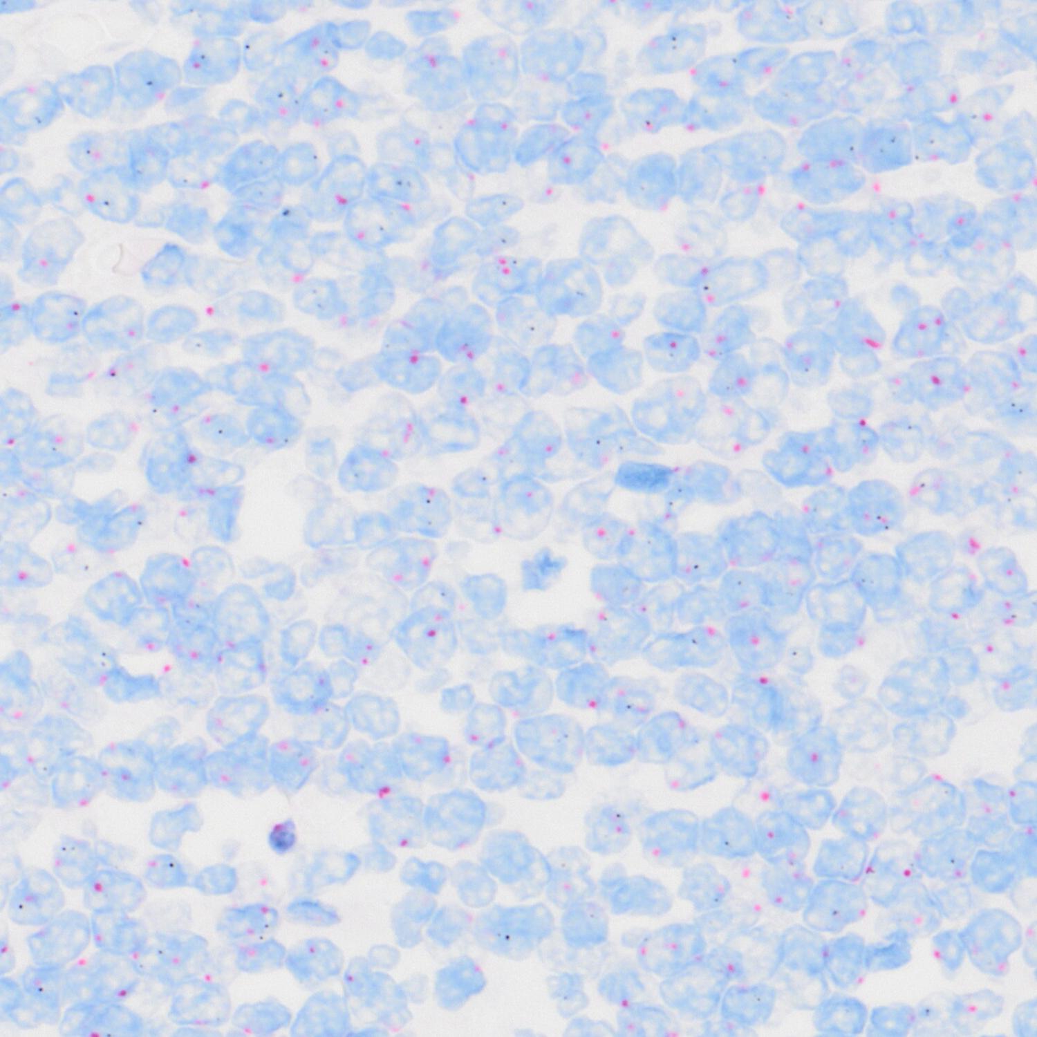 CANCER BOX Object Detection Model by Cancer
