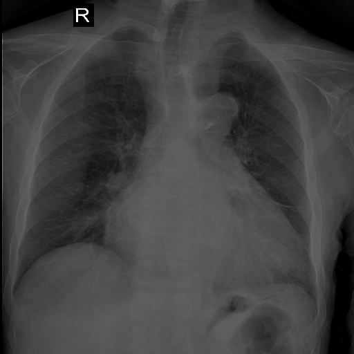 kto bbox Object Detection Dataset by kardi AI