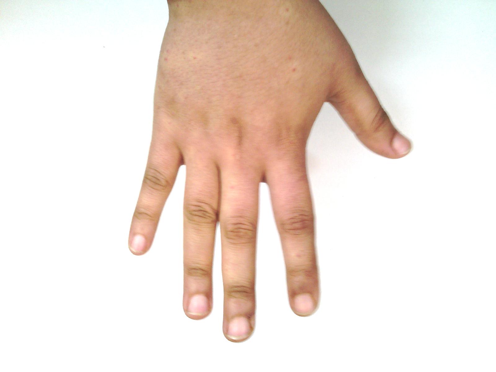 YOLOV51 (yolov51-gvlws) - Roboflow Universe