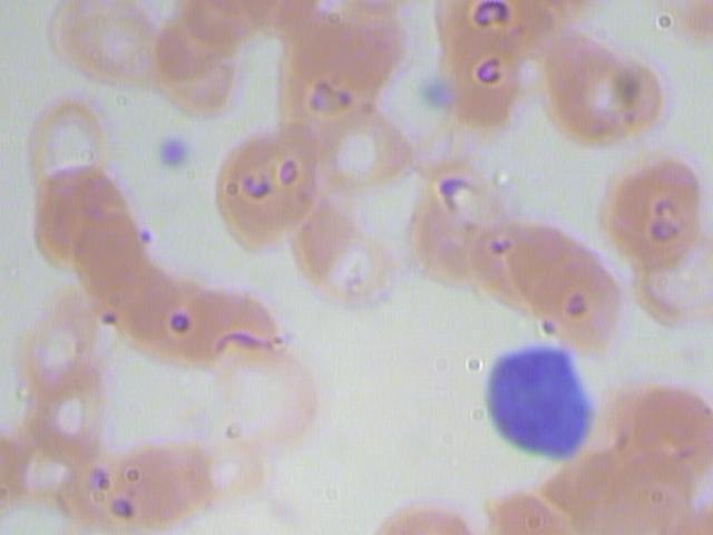 Detecting Components Object Detection Model By Pesitm