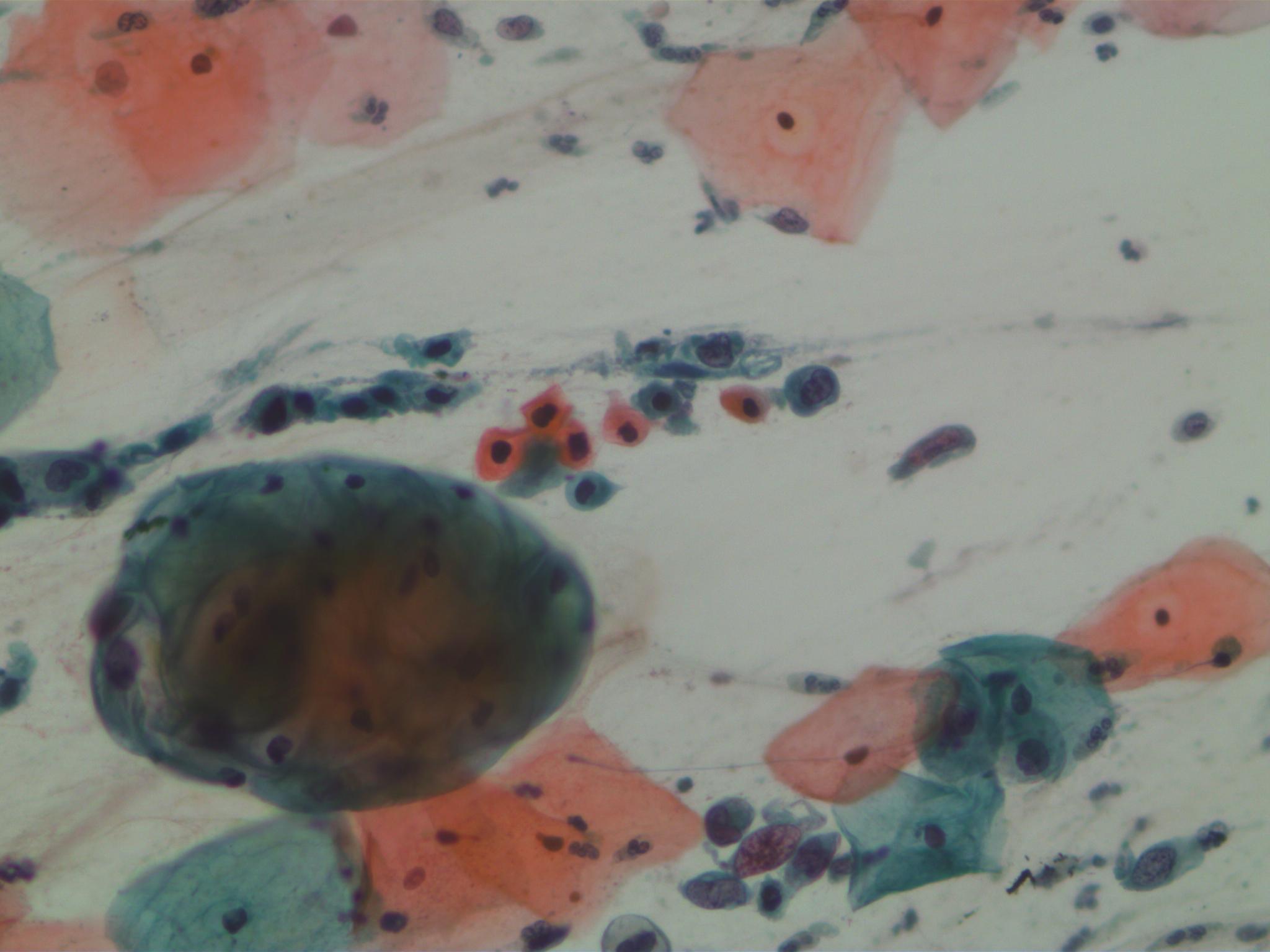 Sipakmed Dataset Object Detection Dataset And Pre Trained Model By Experiment With Cric