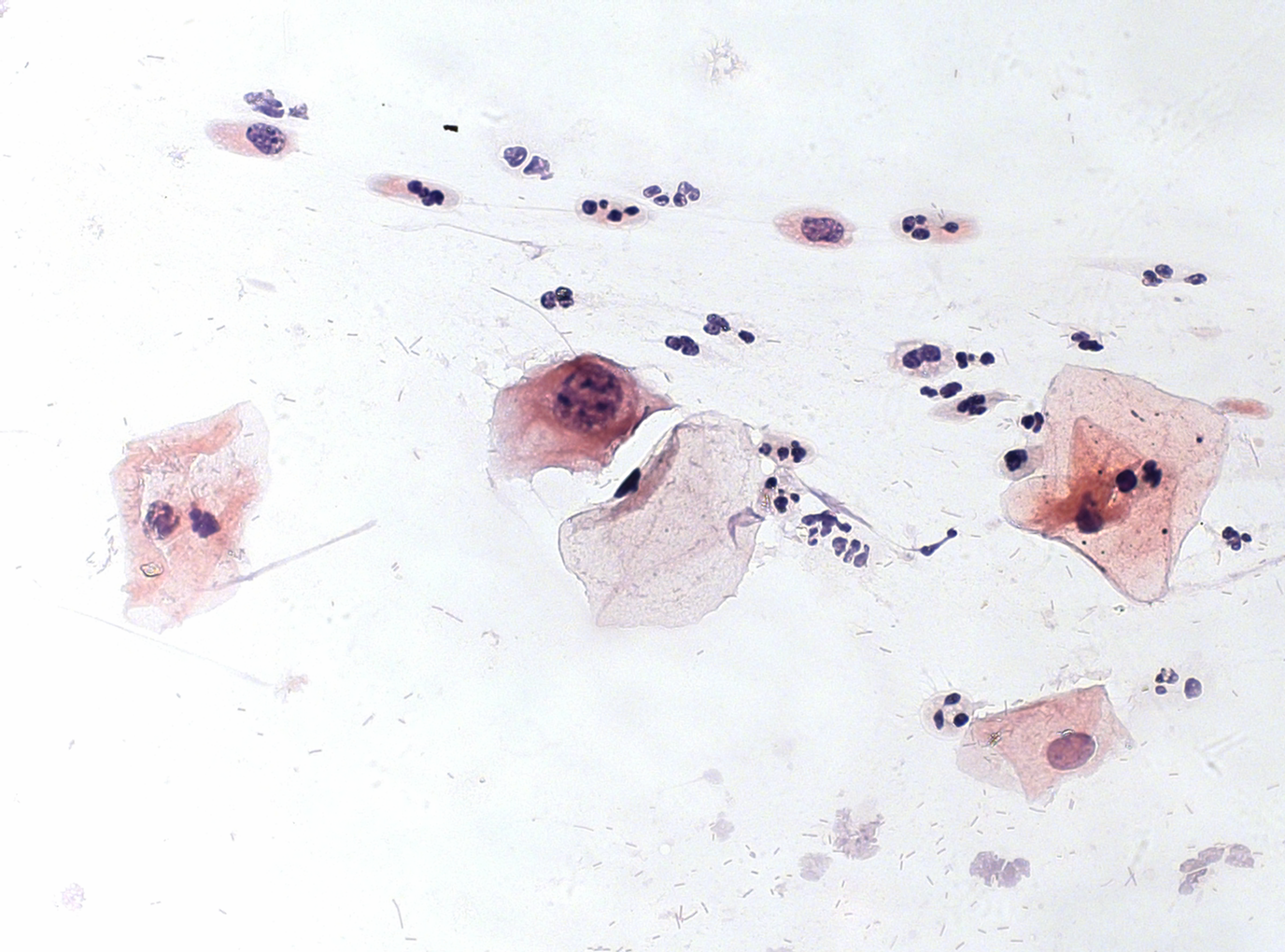 Object Localization Object Detection Dataset By Experiment With Cric