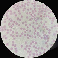 Parasitic inclusion detector - Roboflow Universe