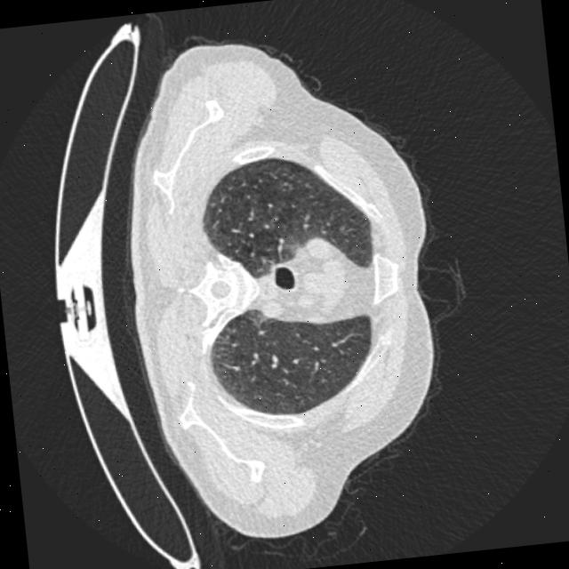 lung cancer Classification Dataset by mk and