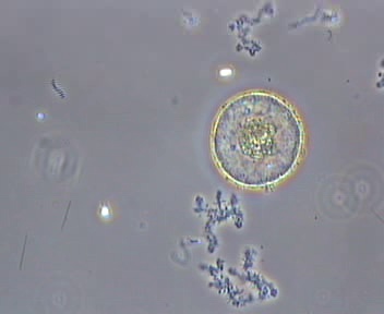 microscope Object Detection Dataset and Pre-Trained Model by microscope