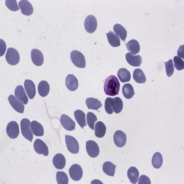 Malaria Detection Object Detection Dataset by Malaria