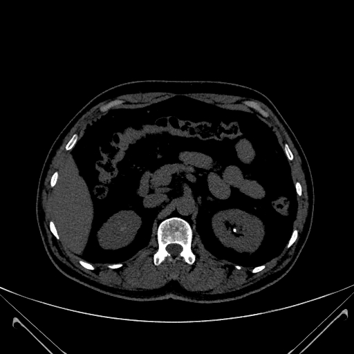 Kidney Segmentation Semantic Segmentation Dataset and Pre-Trained Model by segmentation