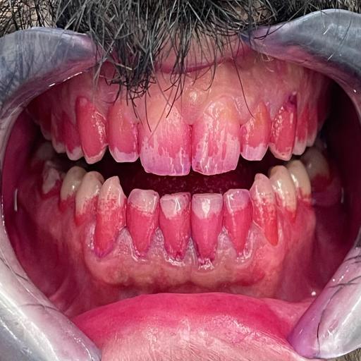 oral_ai-batch1 Object Detection Dataset by oralaisol1