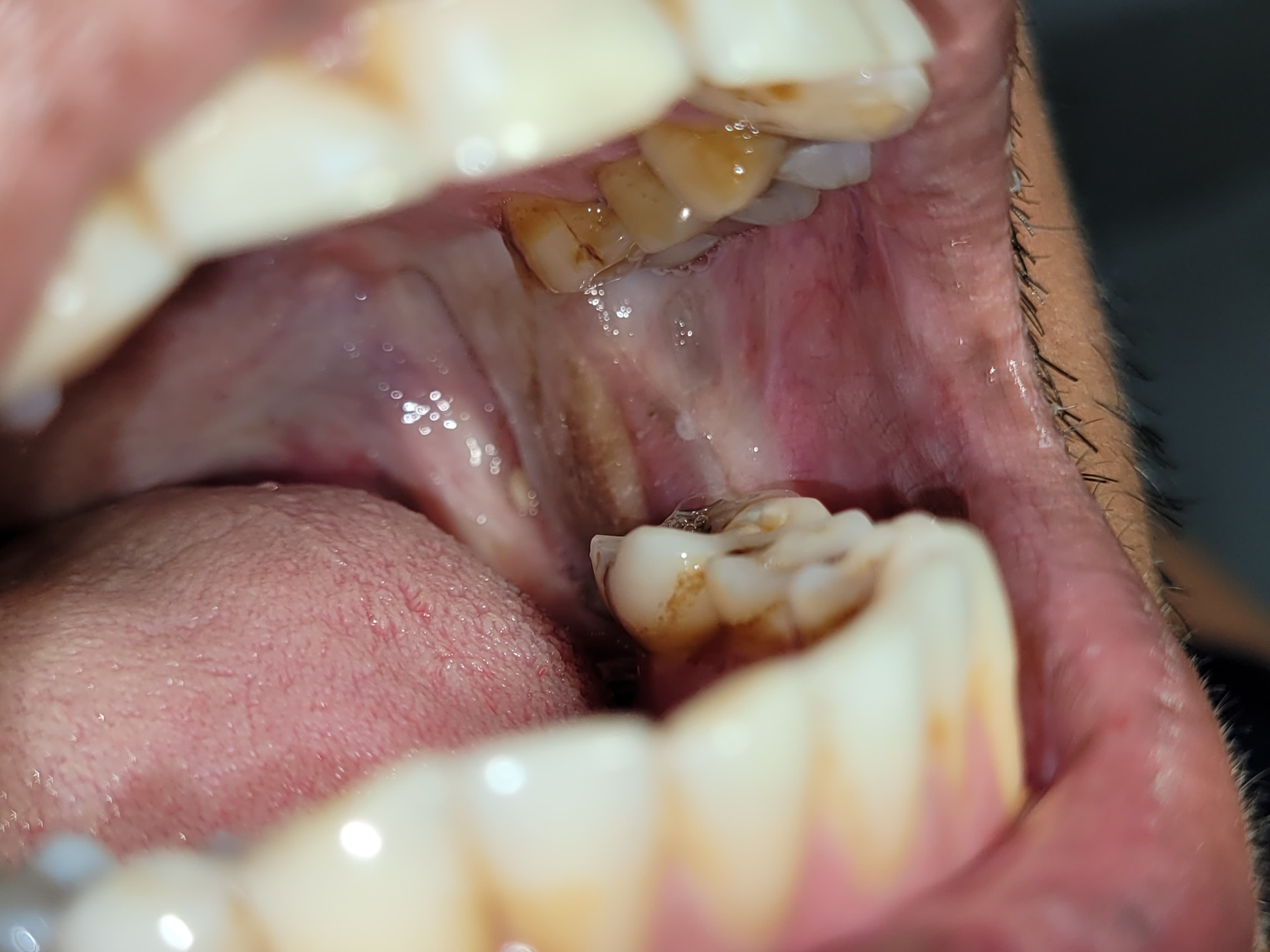 OSMF Object Detection Dataset and Pre-Trained Model by ICMR STS