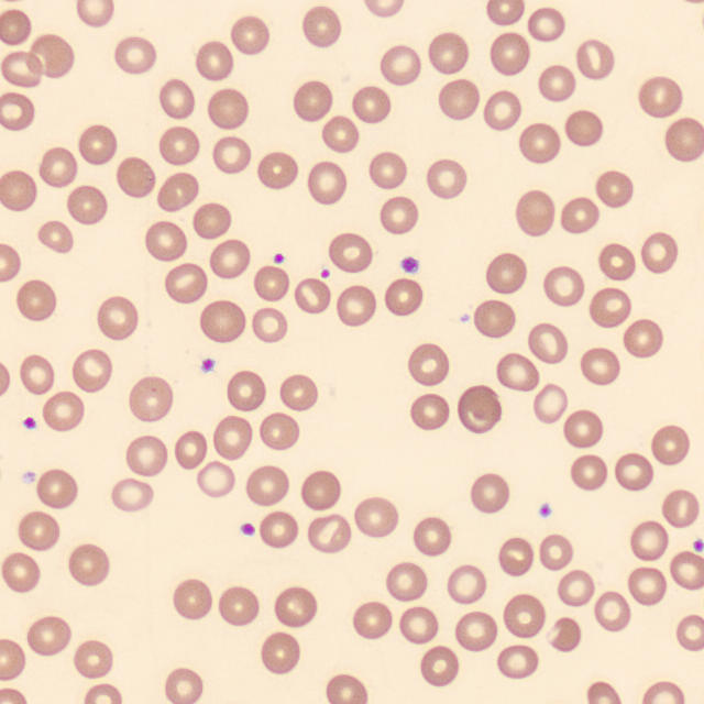 Platelet Object Detection Dataset by Trombosit