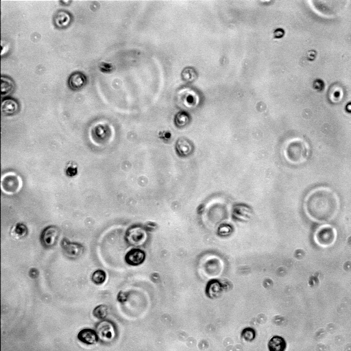 Algae Object Detection Dataset By Algae