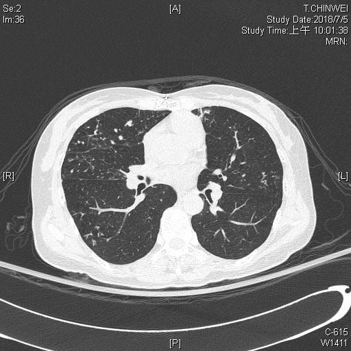Bc Datasets Object Detection Dataset V5 2023 05 03 5 22pm By Cgmh