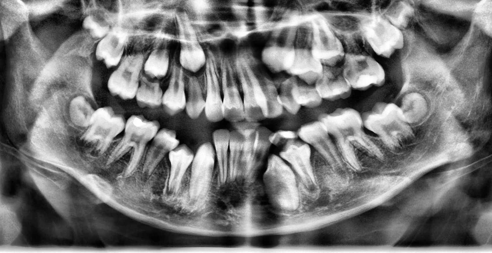 FYP 2 Forensic - Roboflow Universe