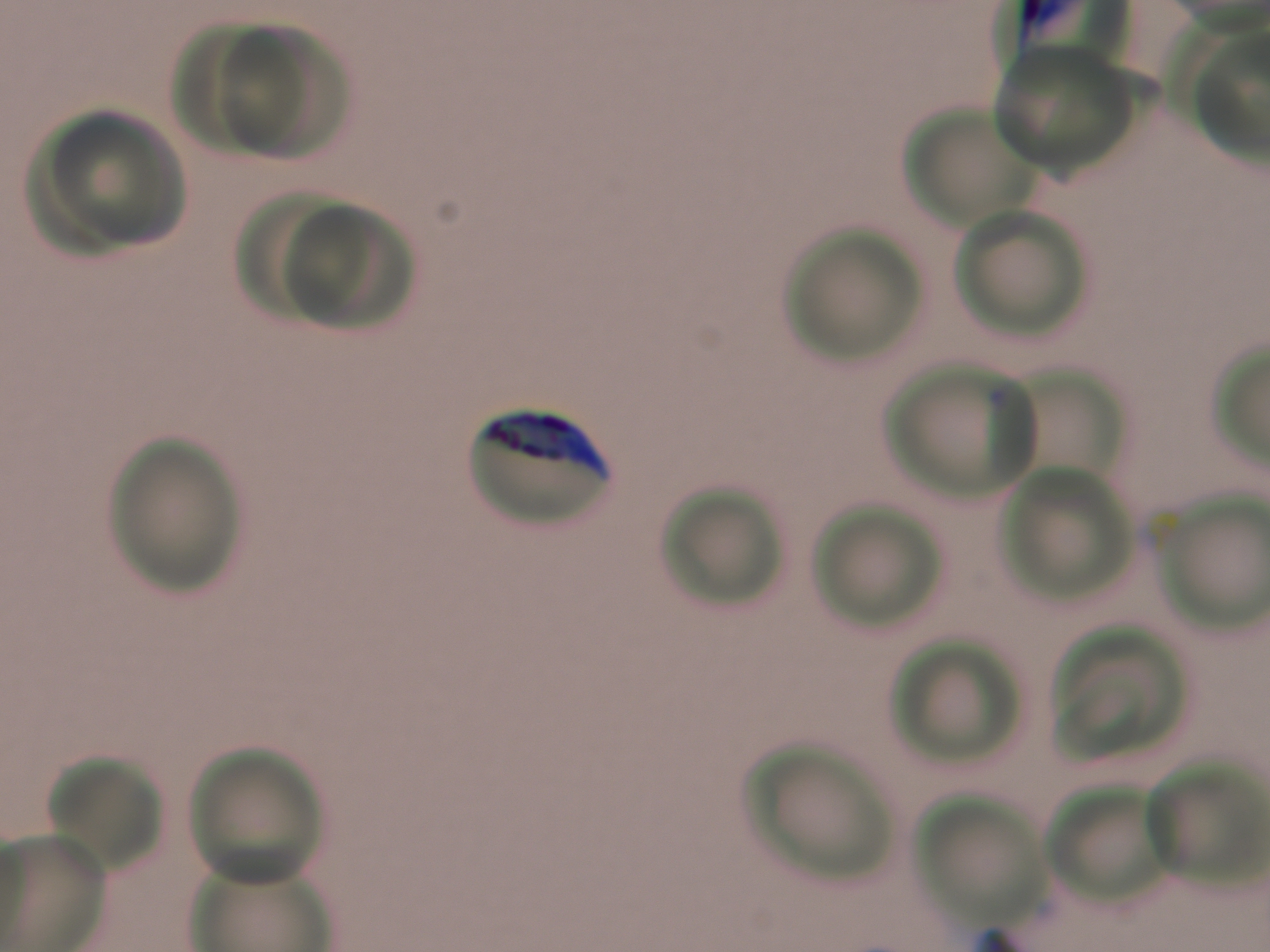 mal_dect_test Object Detection Dataset by Malaria classification