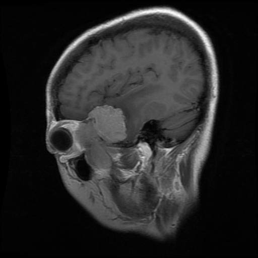 Brain Tumor Object Detection Model by nsh