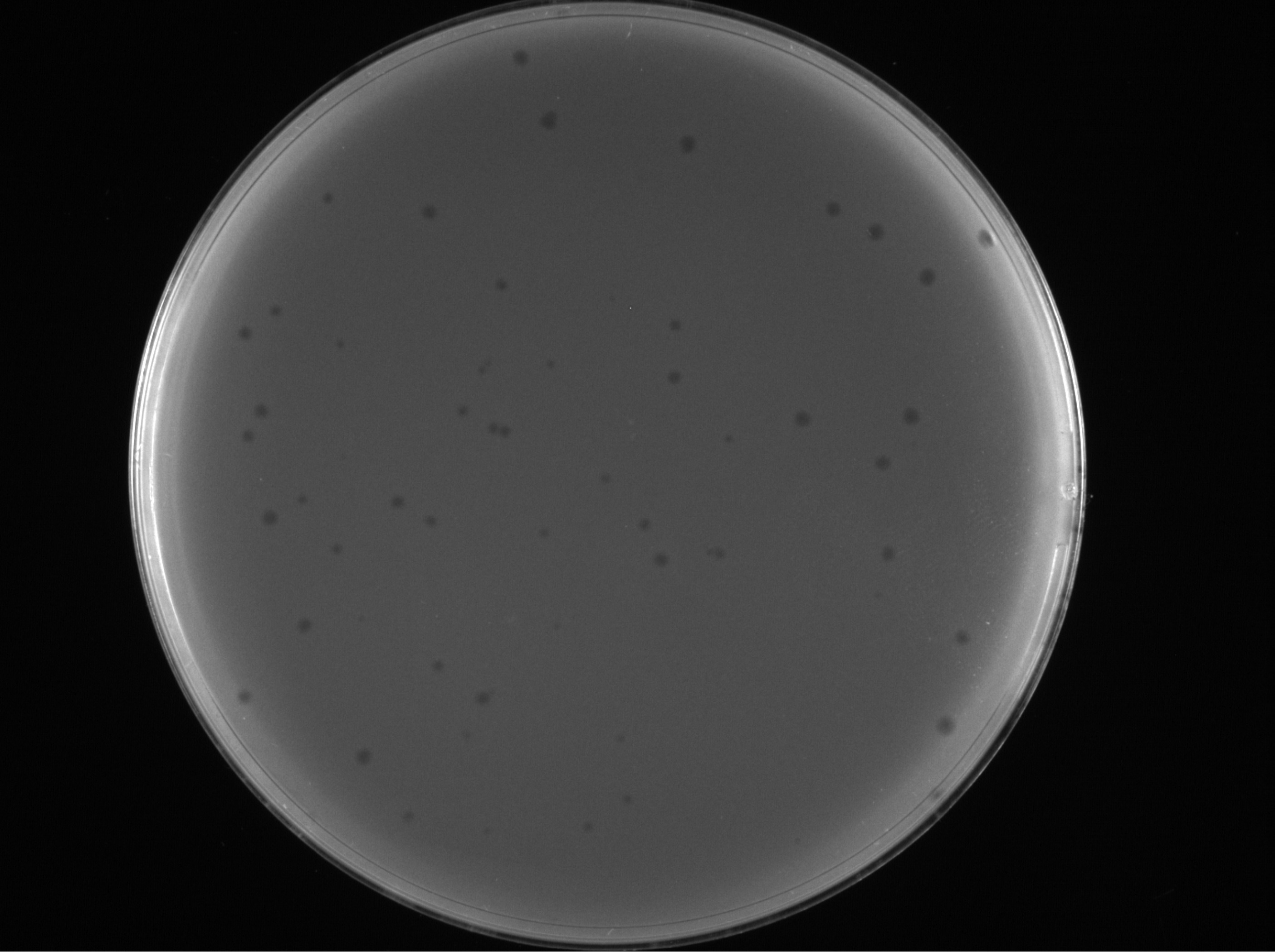 Phage plaque detector Object Detection Dataset and Pre-Trained Model by ...