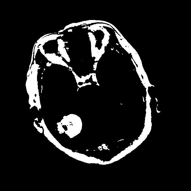 Brain-Tumor-Detection-Segmentation Instance Segmentation Dataset by Newmans