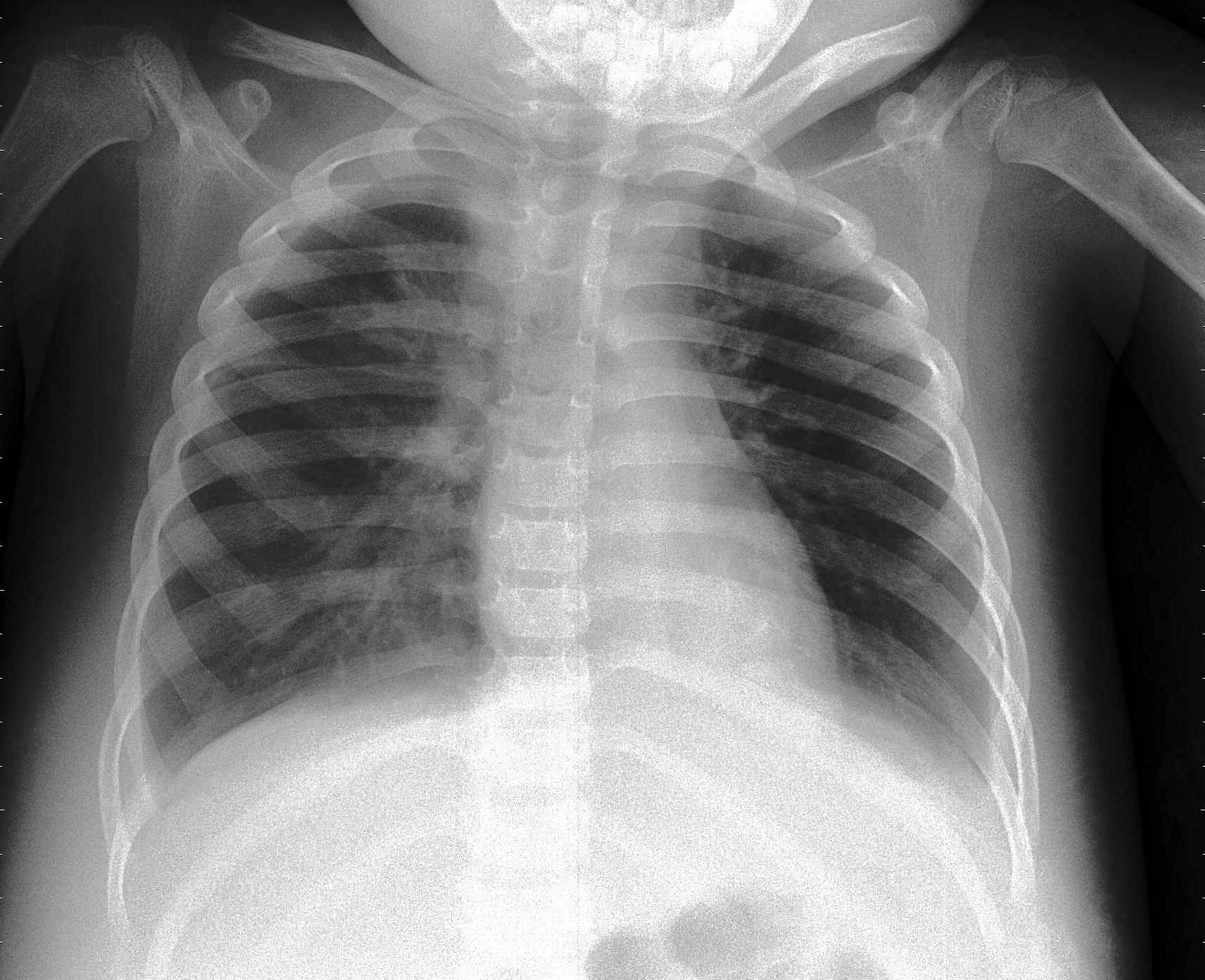 asdf Classification Dataset and Pre-Trained Model by SNU