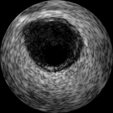 CV-img-seg Instance Segmentation Dataset by Burapha University