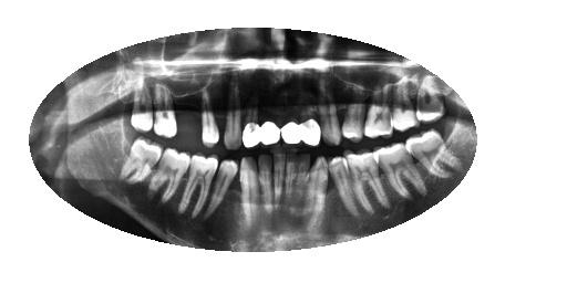 Dental X-ray Object Detection Dataset by AI