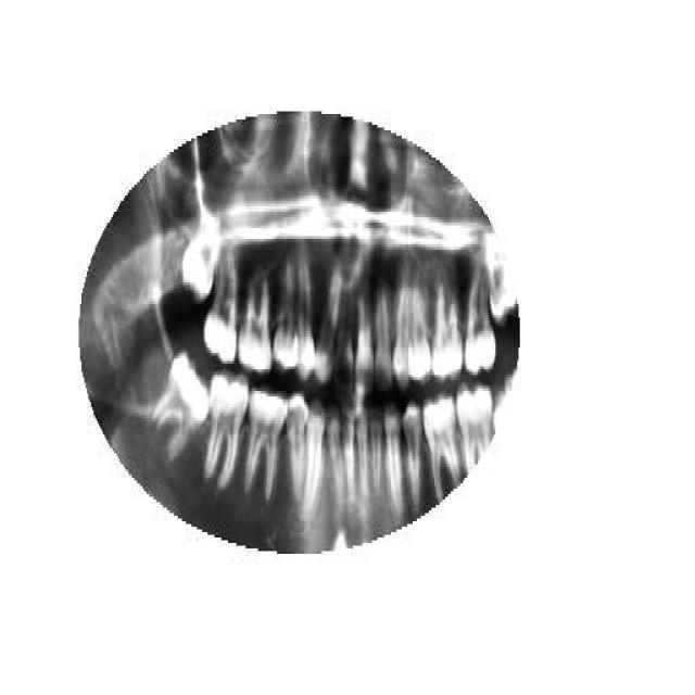 Project Without Augmentation Object Detection Dataset By Augmentation Test
