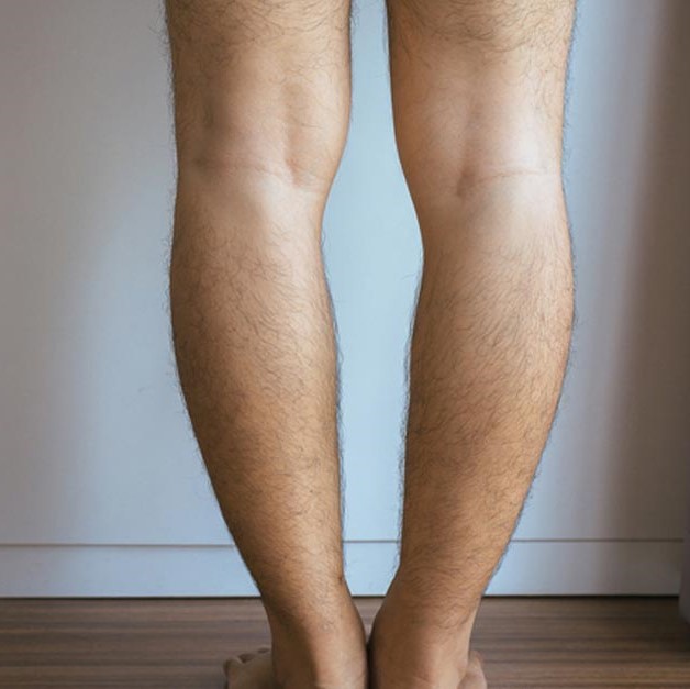 kaki bowlegs Classification Dataset by Mostafa Nady