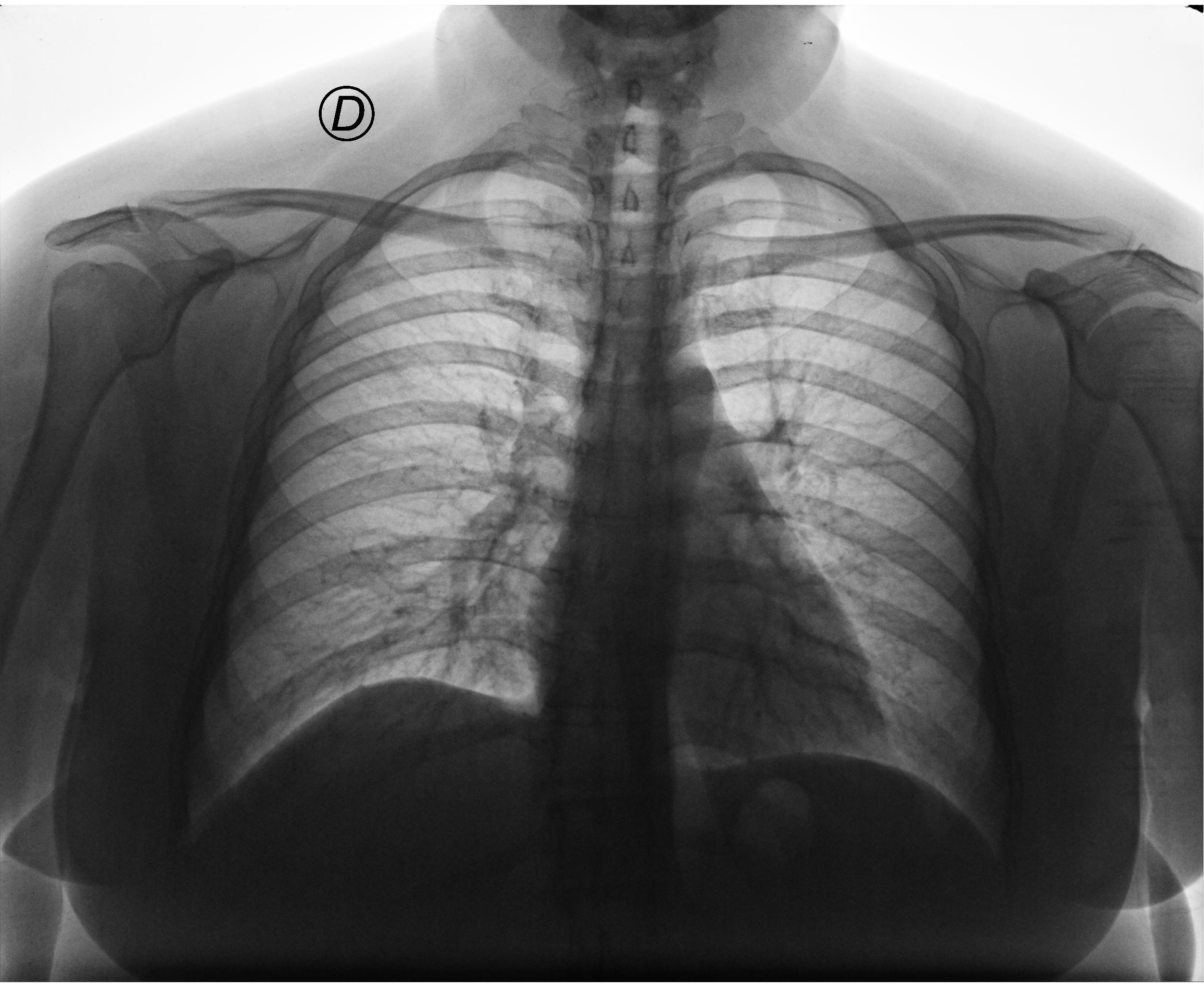 torax Instance Segmentation Dataset and Pre-Trained Model by unab