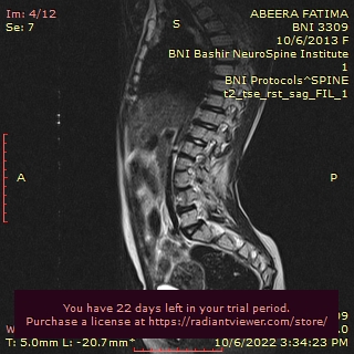 LUMBAR SPINE Instance Segmentation Dataset by lumbarspine
